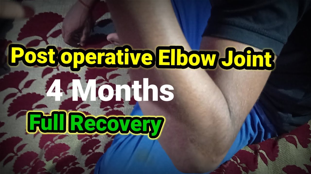 elbow stiffness physiotherapy elbow post operative Fullrecovery 4 month ...