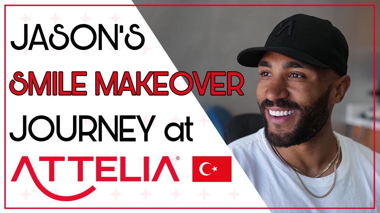 JASON'S SMILE MAKEOVER JOURNEY #attelia #milliondollarsmile - YouTube
