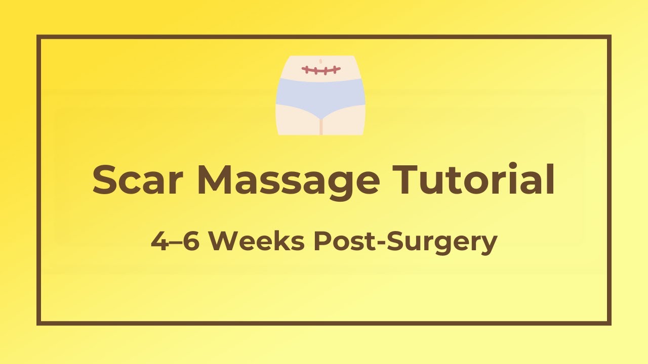 Scar Massage Tutorial (4–6 Weeks Post-Surgery) | Sunshine Holistic ...