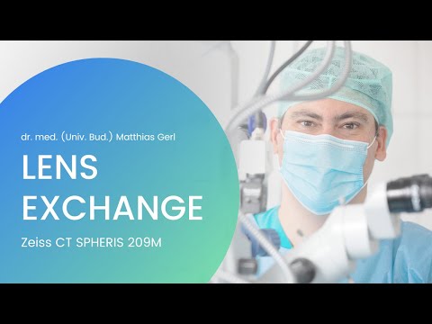 Lens exchange surgery with Zeiss CT SPHERIS 209M - YouTube