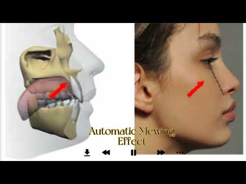[Automatic Mewing] Facial Reconstruction, sharp defined jawline, face ...