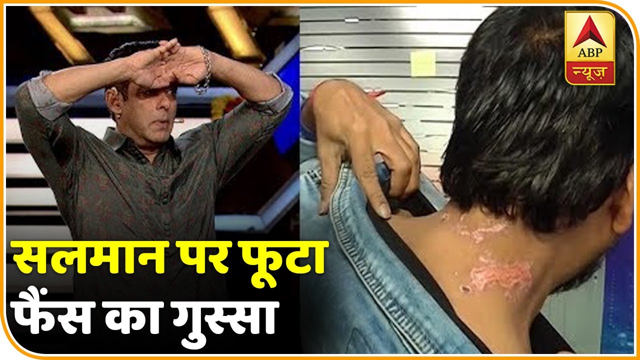 Bigg Boss 13: Siddharth Dey की जली स्किन देख Salman पर फूटा फैंस का ...