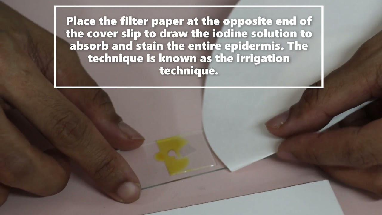 ACTIVITY 2.1 PREPARING AND EXAMINING SLIDES OF PLANT CELLS - YouTube