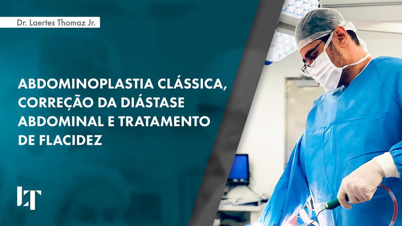 ABDOMINOPLASTIA CLÁSSICA, CORREÇÃO DA DIÁSTASE ABDOMINAL E TRATAMENTO ...