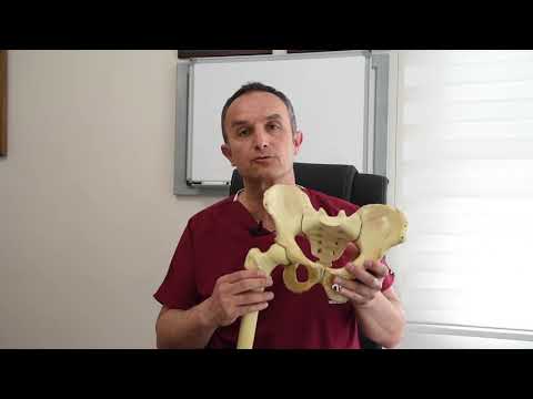 Op.Dr.Kürşat TEKER - Kalça Sıkışma Sendromu