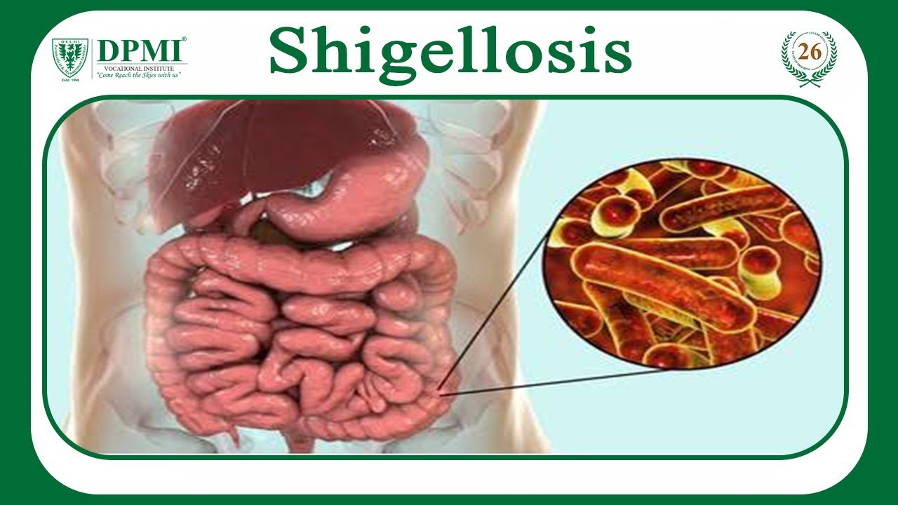 Shigellosis: What Causes Shigellosis? Shigella: Morphology ...