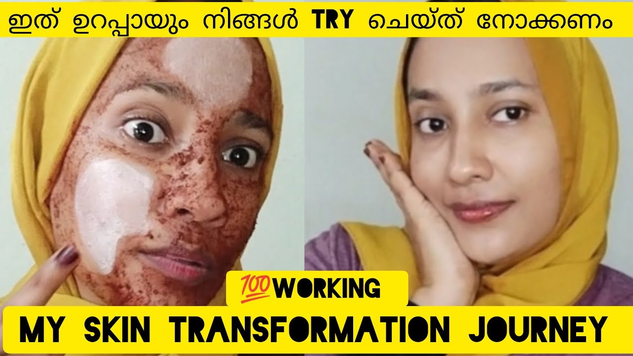 My Skin transformation journey/Skin brightening/എന്റെ skin tone ഞാ ...