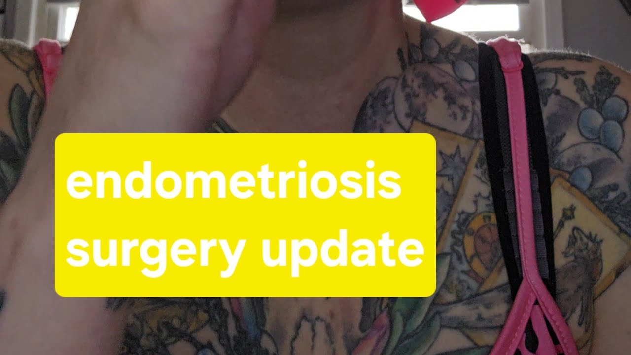 Endometriosis Surgery Update (pre-surgery) - YouTube