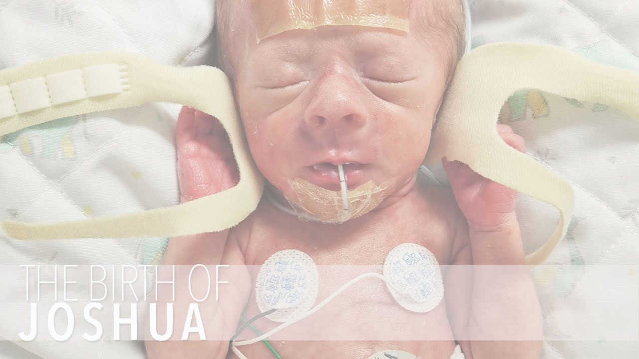 Joshua's Unique Birth Story | 30 week old premature baby | Precious ...