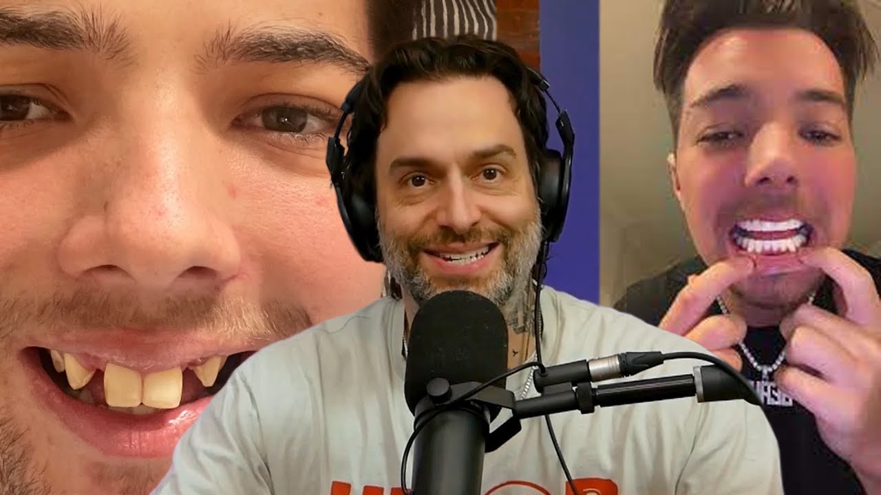 Chris D'Elia Reacts to Beavo's New Teeth - YouTube