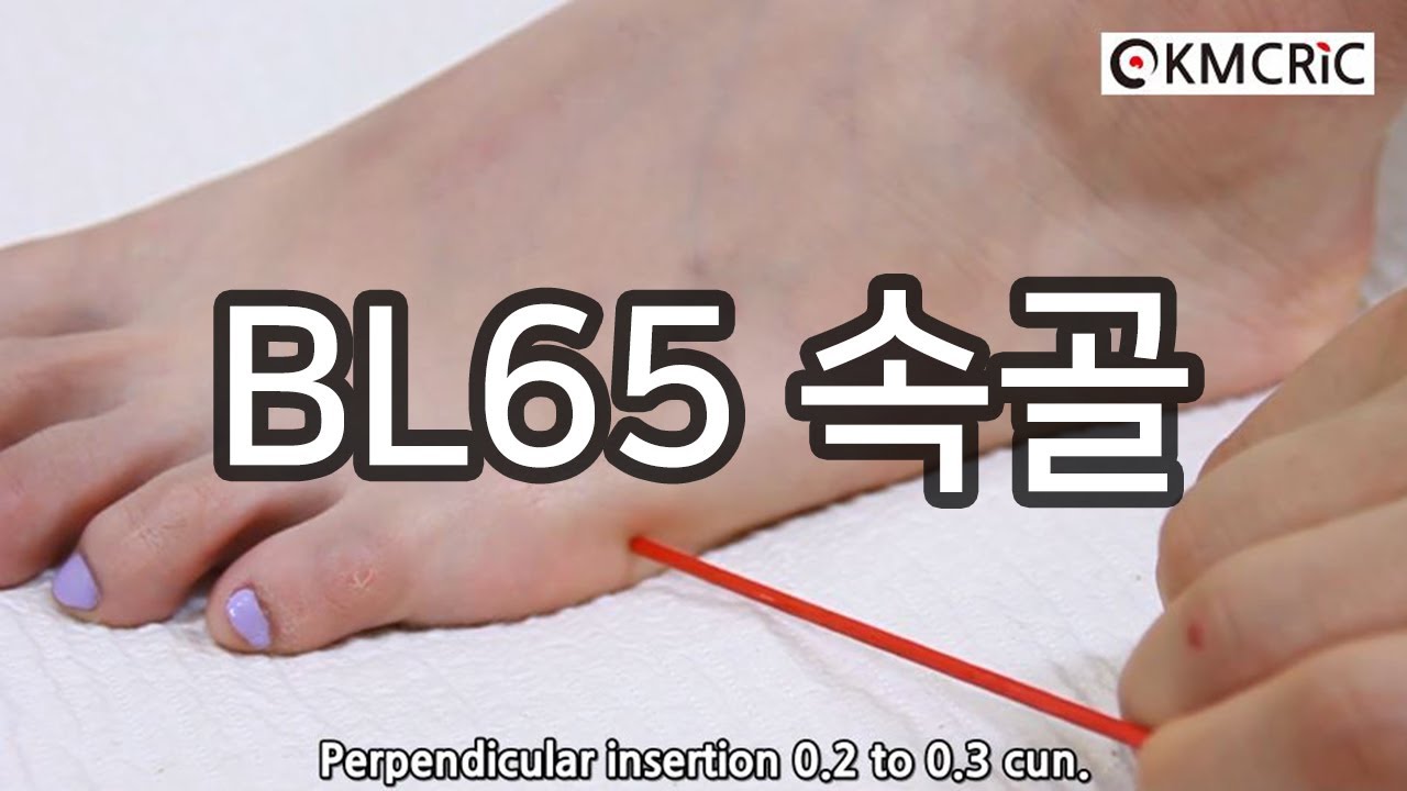 BL65 속골 束骨 Shugu (Eng sub) - KMCRIC WHO Standard acupoint DB - YouTube