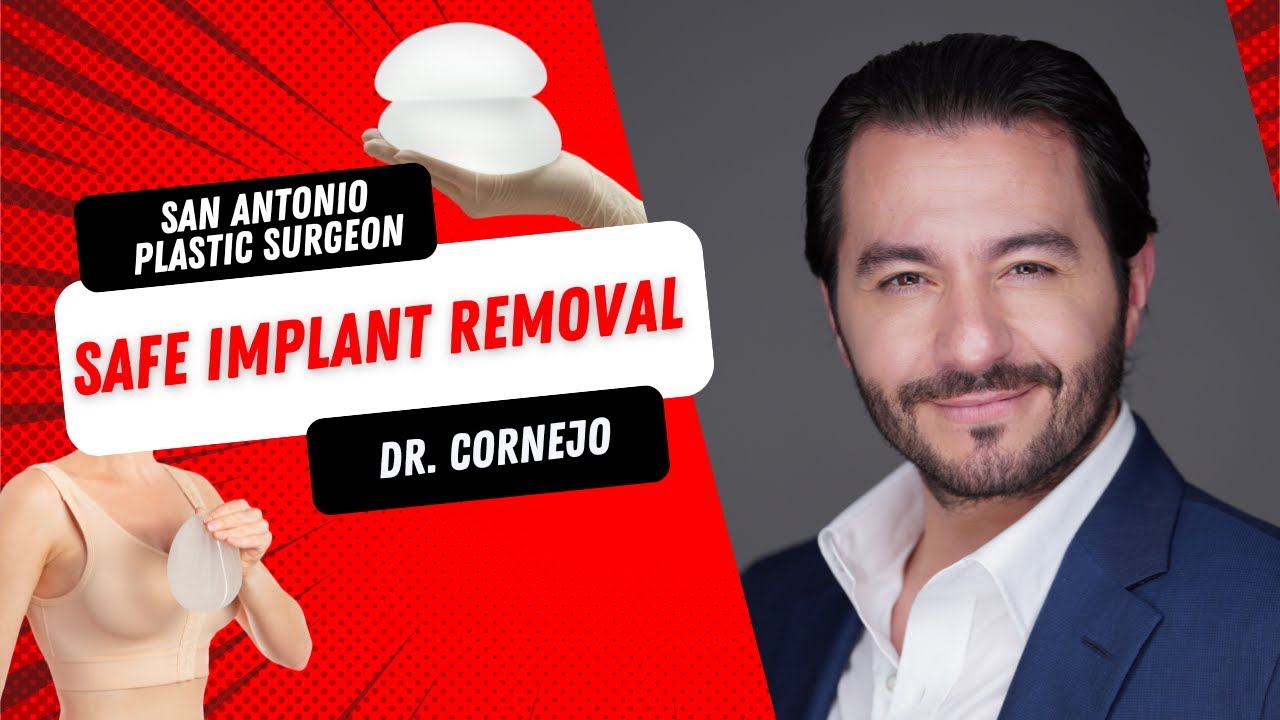Safe Implant Removal with Dr. Cornejo (Dr. Latin Heat) in San Antonio ...