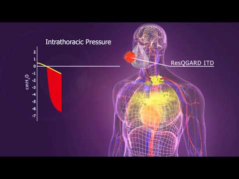 ResQGARD Impedance Threshold Device - YouTube
