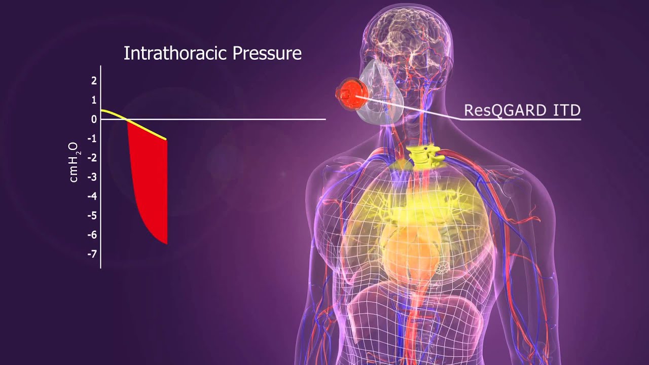 ResQGARD Impedance Threshold Device - YouTube
