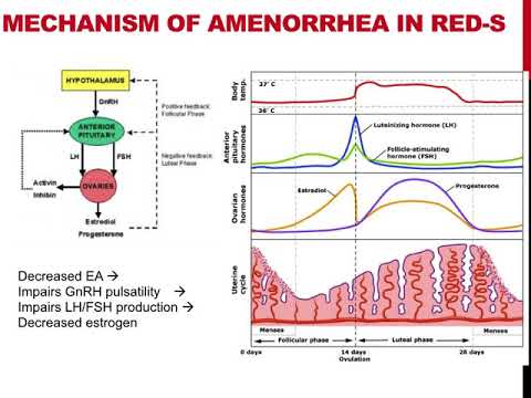 Sports Medicine Lectures | RED-S / Female Athlete Triad | February 2018 ...