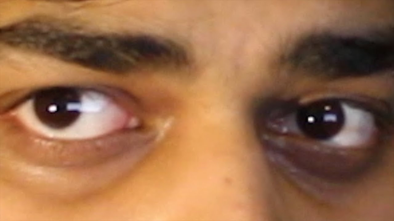 For Those Concerned About My Health... - YouTube