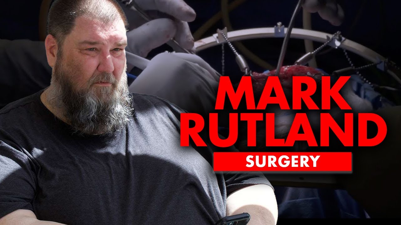 Did Mark Rutland have surgery after ‘My 600-Lb Life’? - YouTube