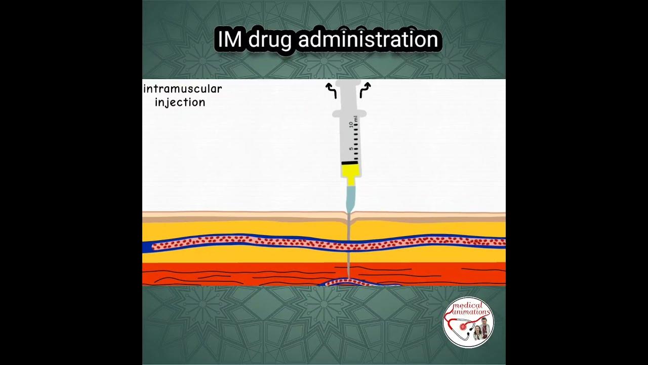💉 INTRAMUSCULAR (IM) INJECTION, PROCEDURE | ANIMATED EXPLANATION - YouTube