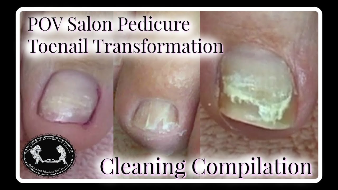 #3 POV Salon Pedicure Tutorial Toenail Transformation Compilation Big ...