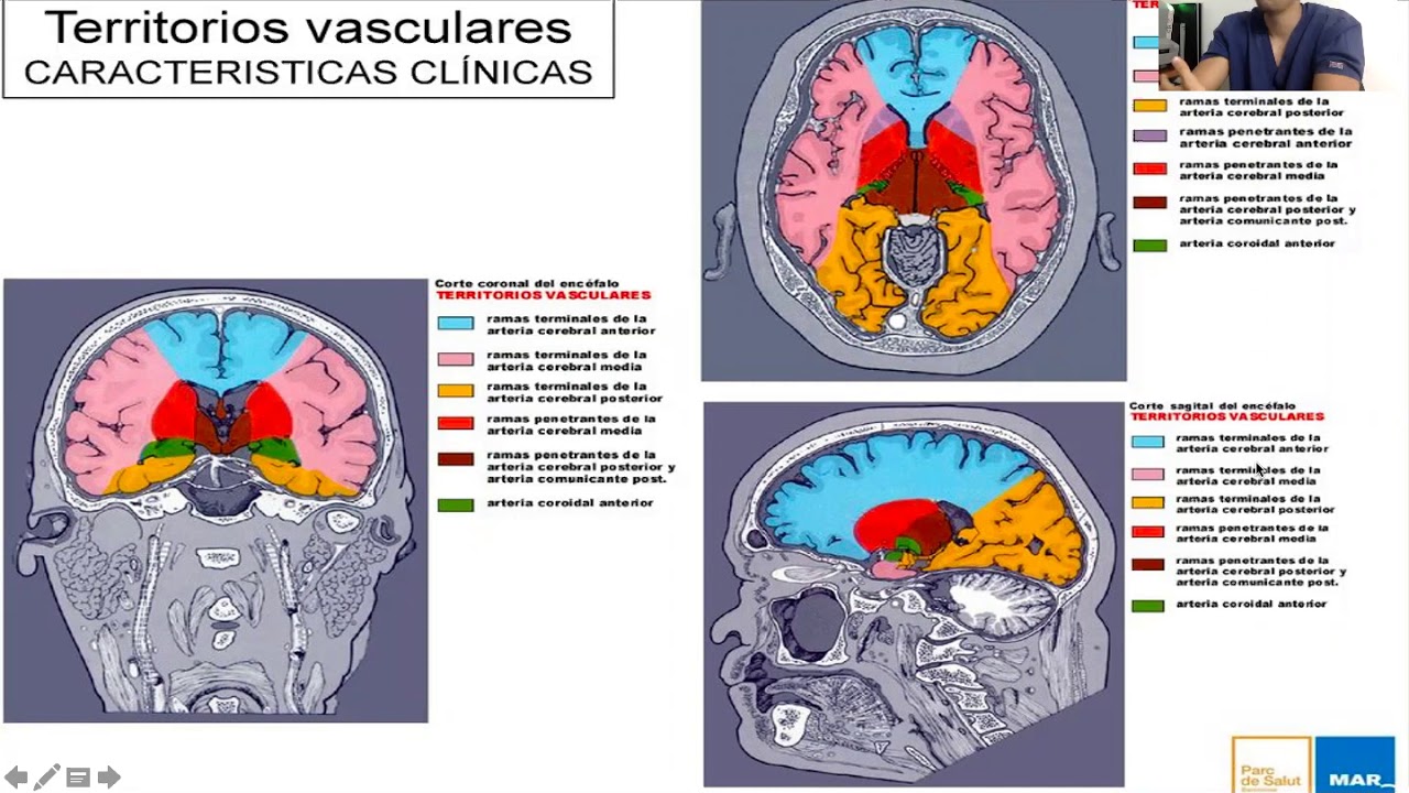 Anatomía Del Tc Pns Heterogeneity Of Neuroinflammatory Responses In