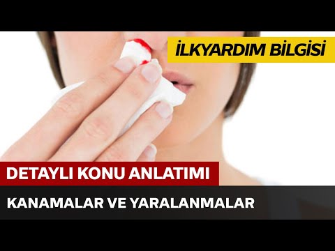 İlkyardım Bilgisi / Kanamalar ve Yaralanmalar
