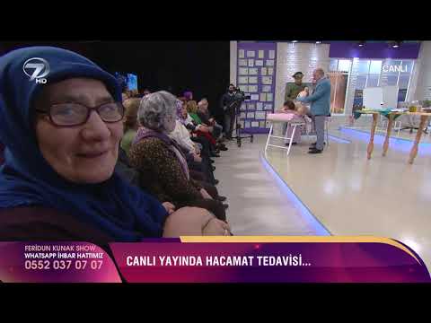 Hacamat Nasıl Yapılır Uygulamalı Anlatım