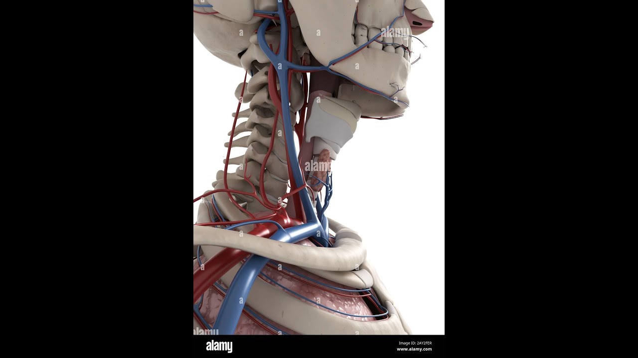 Anastomosis Lupiae vascular graft branch and the brachiocephalic trunk ...