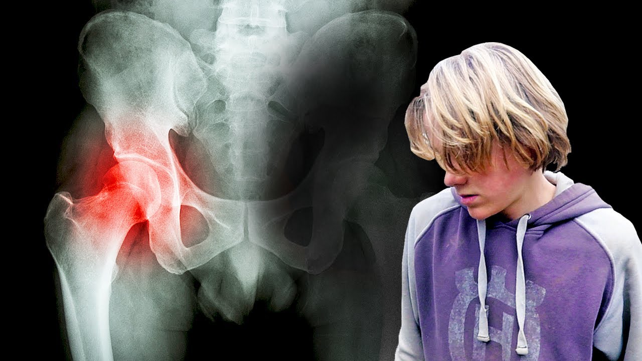 His Bone is Dying | the day before his (3rd) Surgery - YouTube