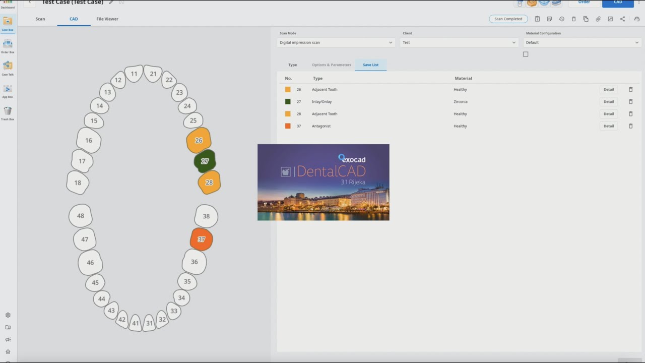 * IDDA MiniBytes - How to Scan in MEDIT, Design in EXOCAD then Mill ...