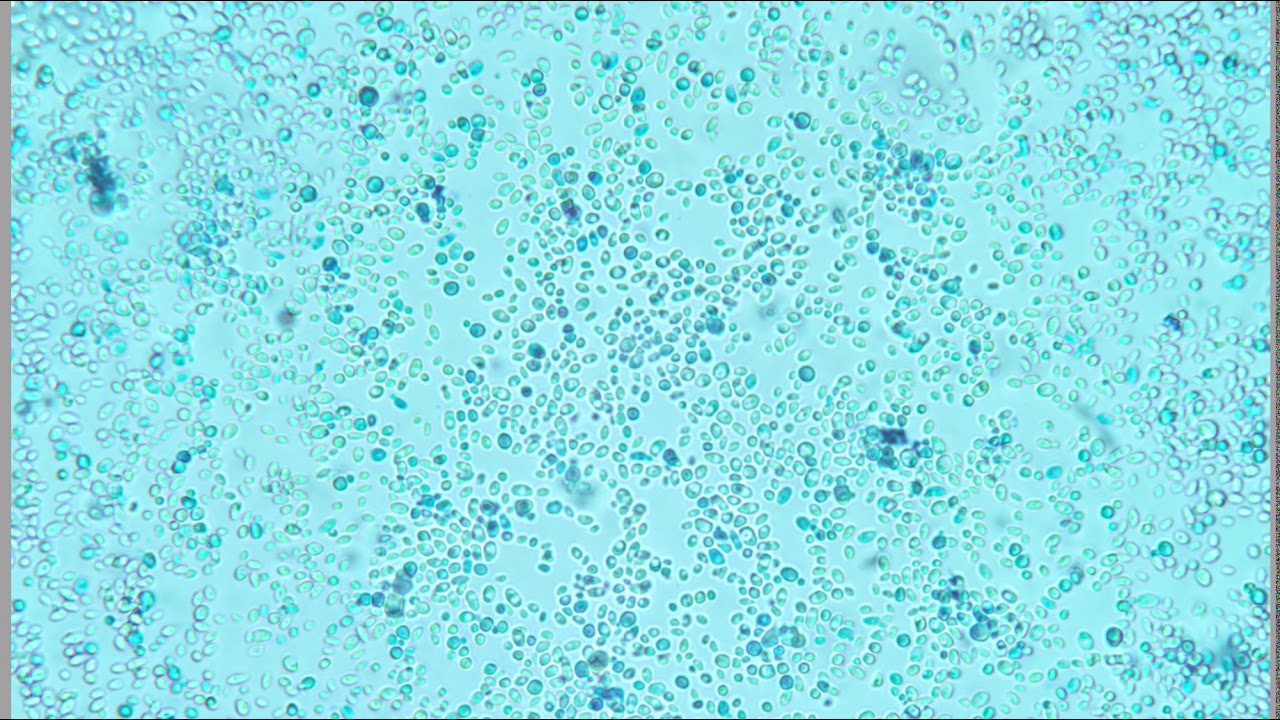 Active Yeast Cells Under the Microscope X40 - YouTube