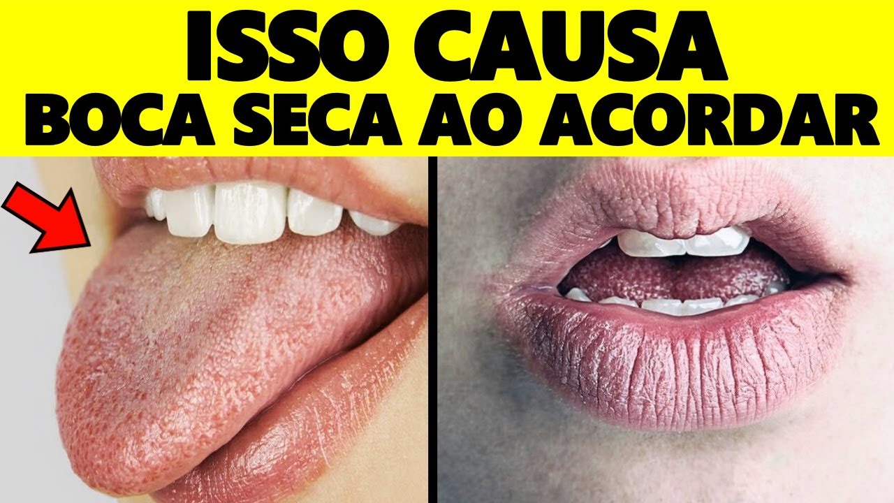 Por esse Motivo você fica com a BOCA SECA ao ACORDAR e COMO CURAR - YouTube