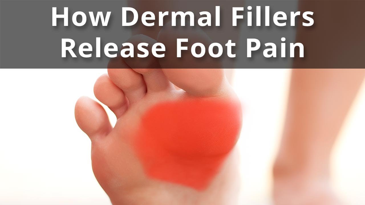 How Dermal Fillers Relieve Foot Pain - YouTube