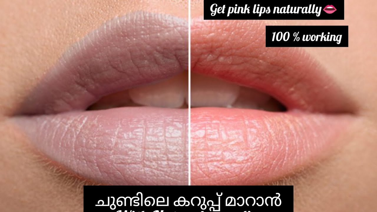 Get pink lips naturally ചുണ്ടിലെ കറുപ്പ് മാറാൻ... 100% working - YouTube