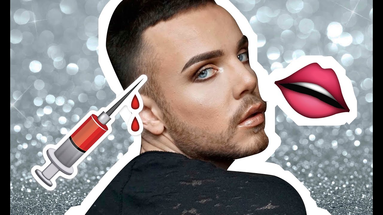 LIPFILLERS & BOTOX bij Amsterdam Aesthetics ★ Mishel Bronx - YouTube