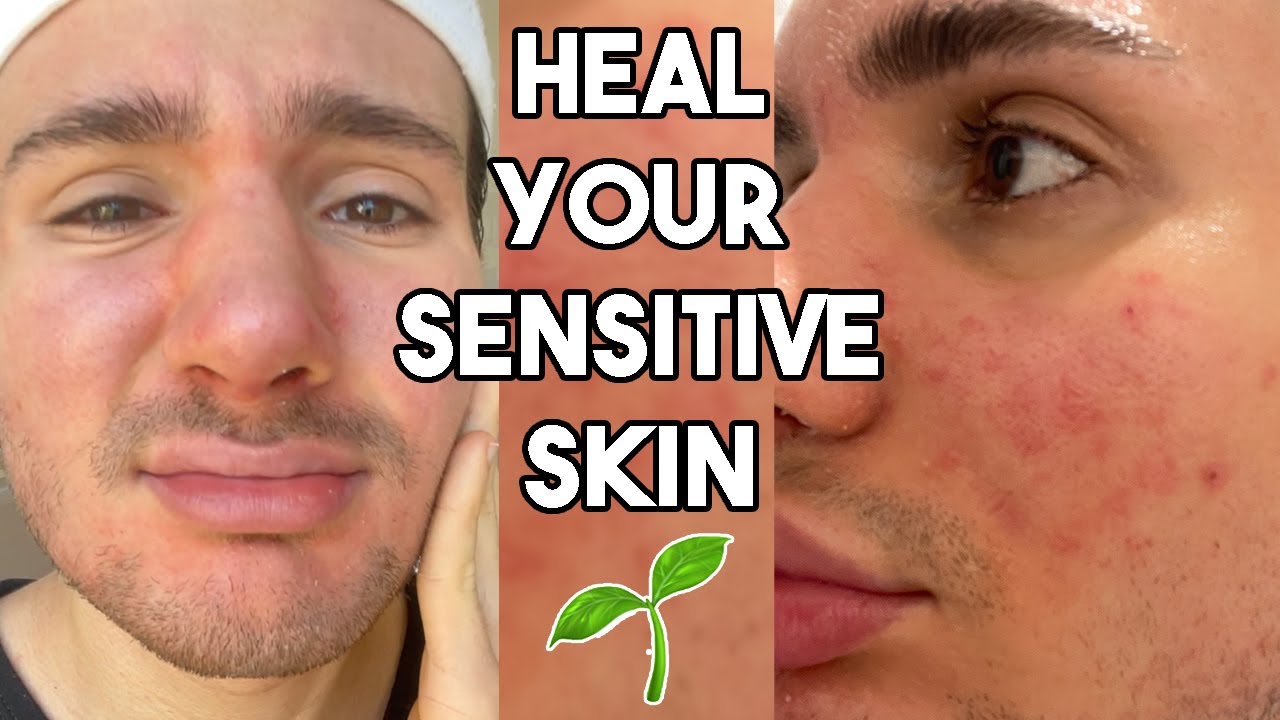 How to Soothe Sensitive Skin! |💥 | Skincare Routine for Irritated Skin ...