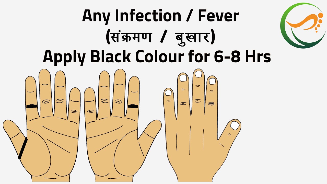 Any Infection | fever | Color Therapy | इन्फेक्शन | बुखार - YouTube