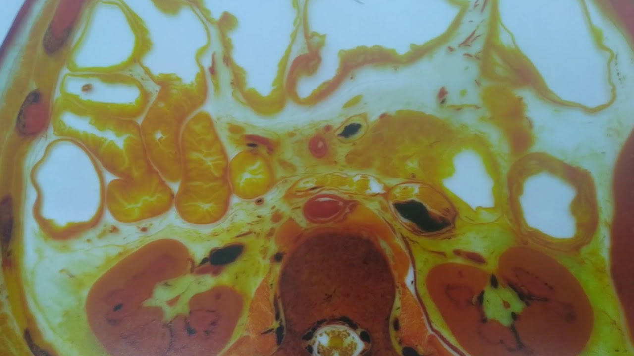 abdomen sheet plastinate 02 - YouTube