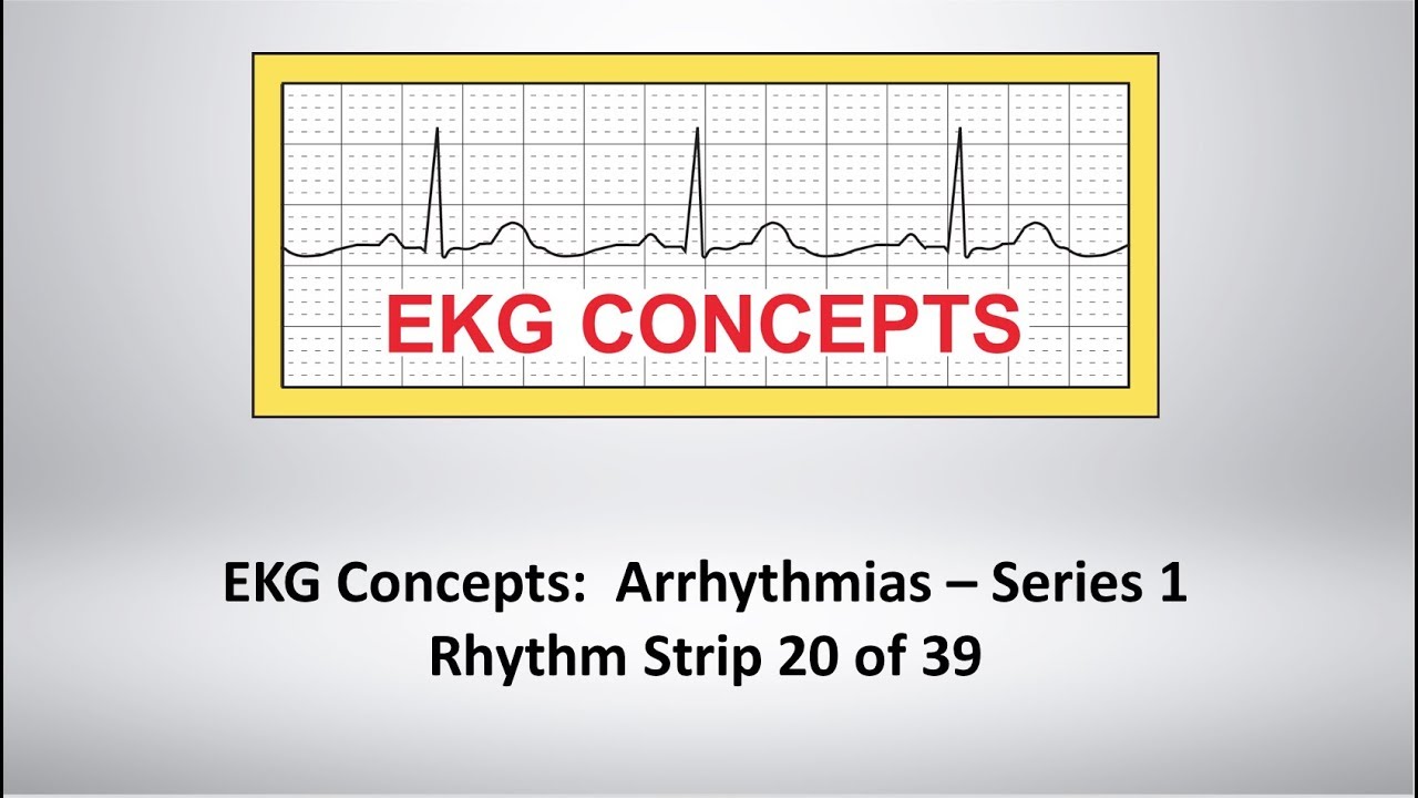 EKG Concepts: Arrhythmias Course - Strip 20 of 39 - YouTube