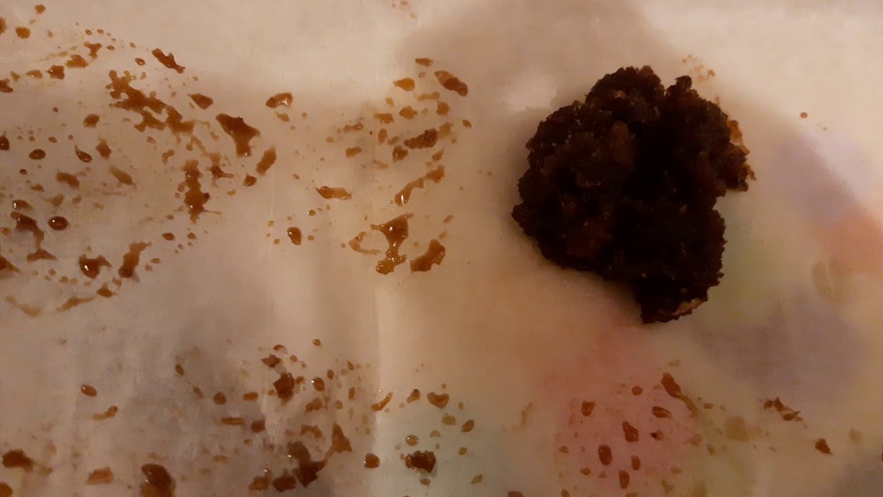 Jamaican busta candy # stagaback #busta - YouTube