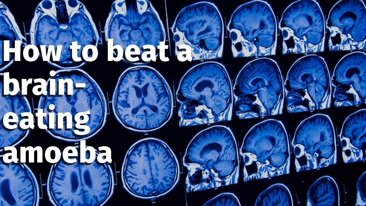 How to beat a brain-eating amoeba - YouTube
