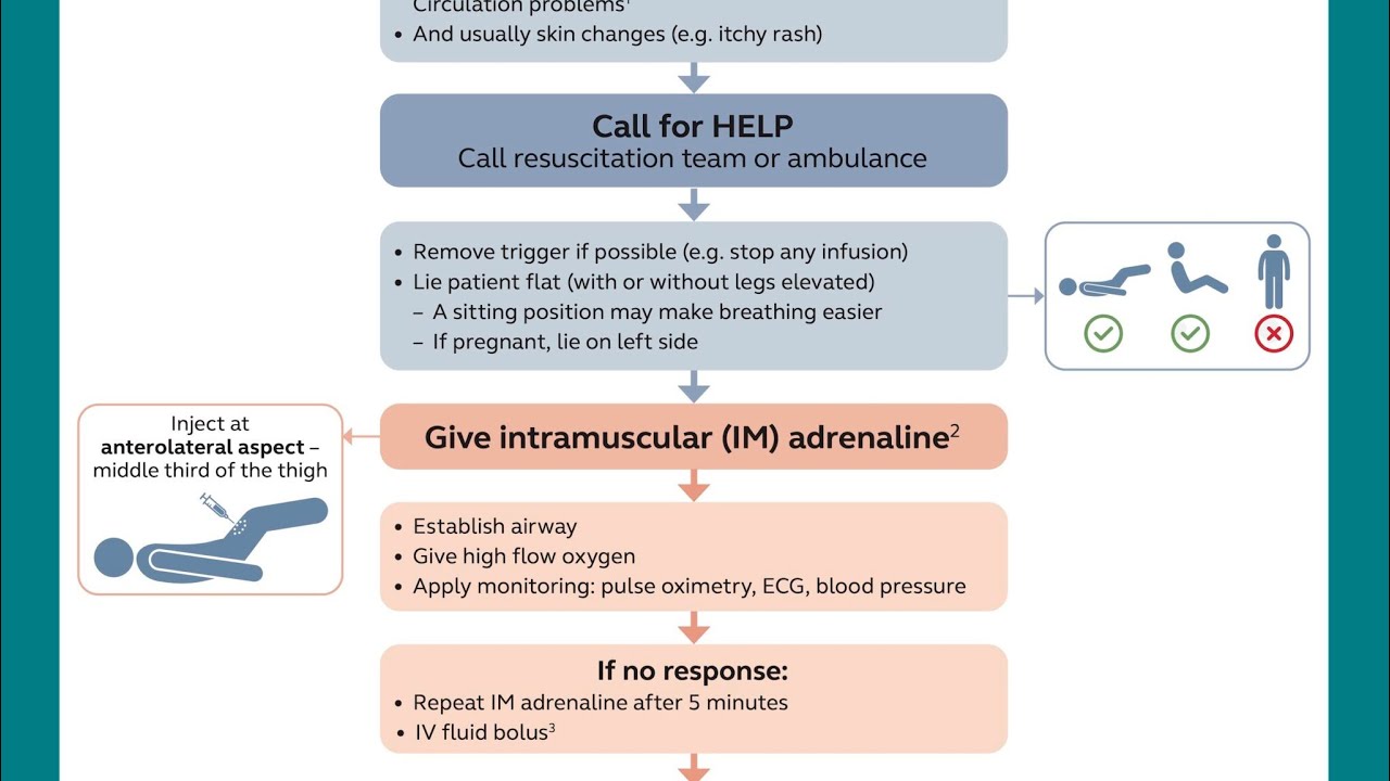 Mastering Anaphylaxis in Cardiac Arrest :ALS Guidelines Explained - YouTube