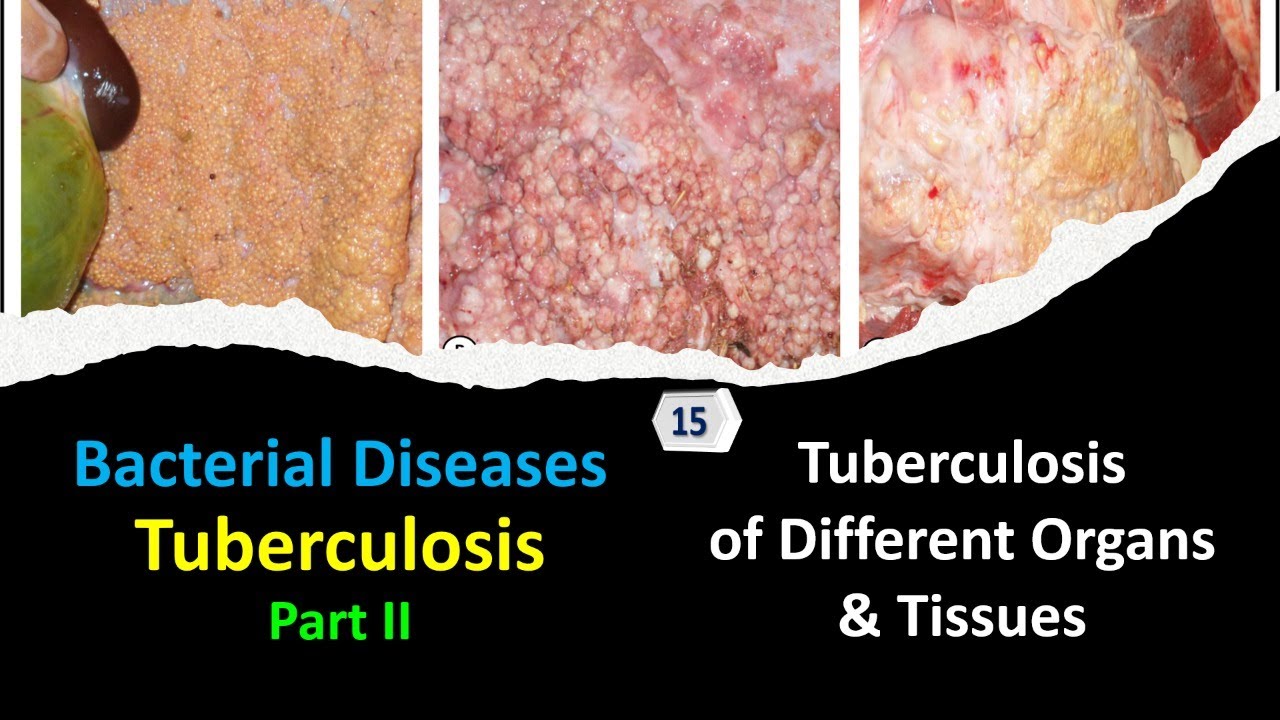 Lecture 15: BovineTuberculosis (Part II) of different organs & tissues ...