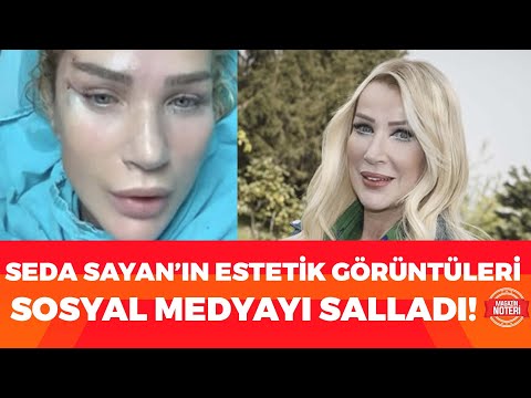 Seda Sayan’ın Estetik Görüntüleri Sosyal Medyayı Salladı! İşte Estetikli Tüm Ünlüler...