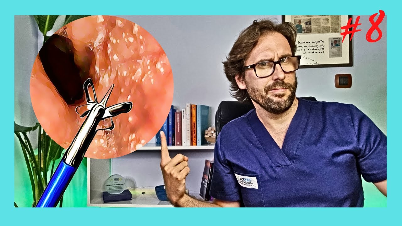 🧐 5 PATOLOGÍAS que debes BIOPSIAR en el esófago. | CURSO ENDOSCOPIA ...