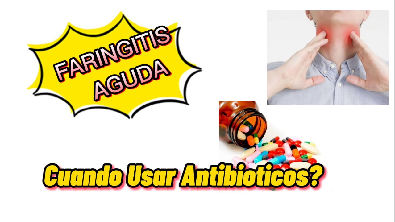 CUANDO DAR ANTIBIOTICOS A UNA FARINGITIS | USANDO CRITERIOS MÉDICOS 🤓 ...