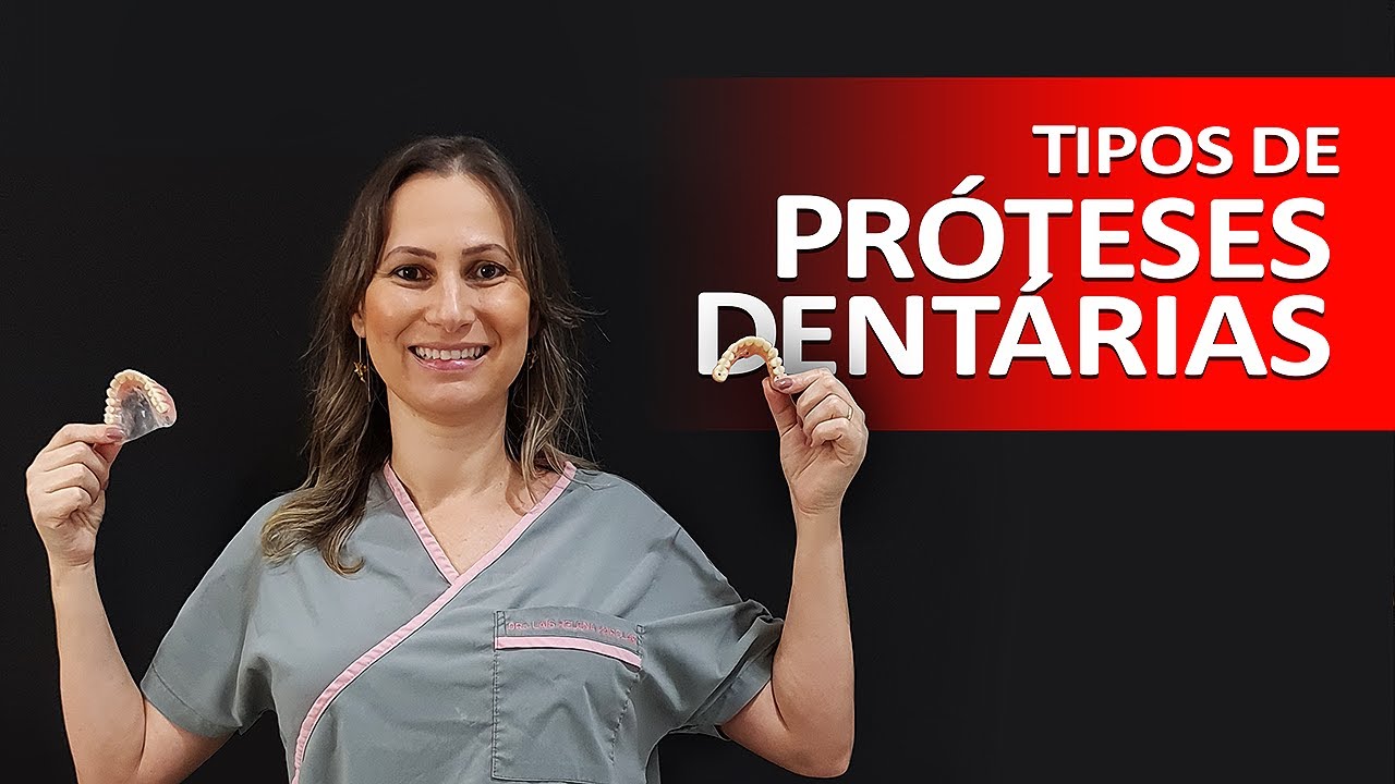 [PRÓTESES DENTÁRIAS] Tipos de próteses (Dentadura, Ponte Fixa, Ponte ...