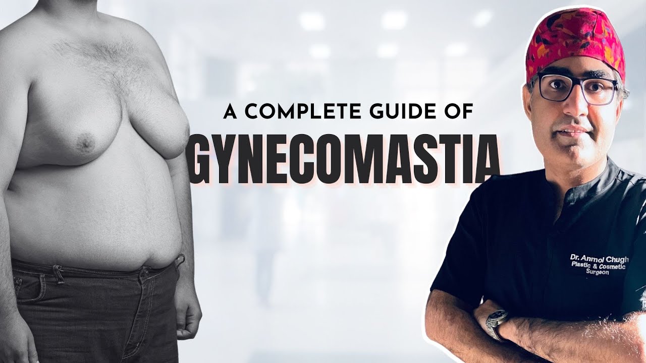 What is Gynecomastia | #Gynecomastia Cost in India | Recovery After ...
