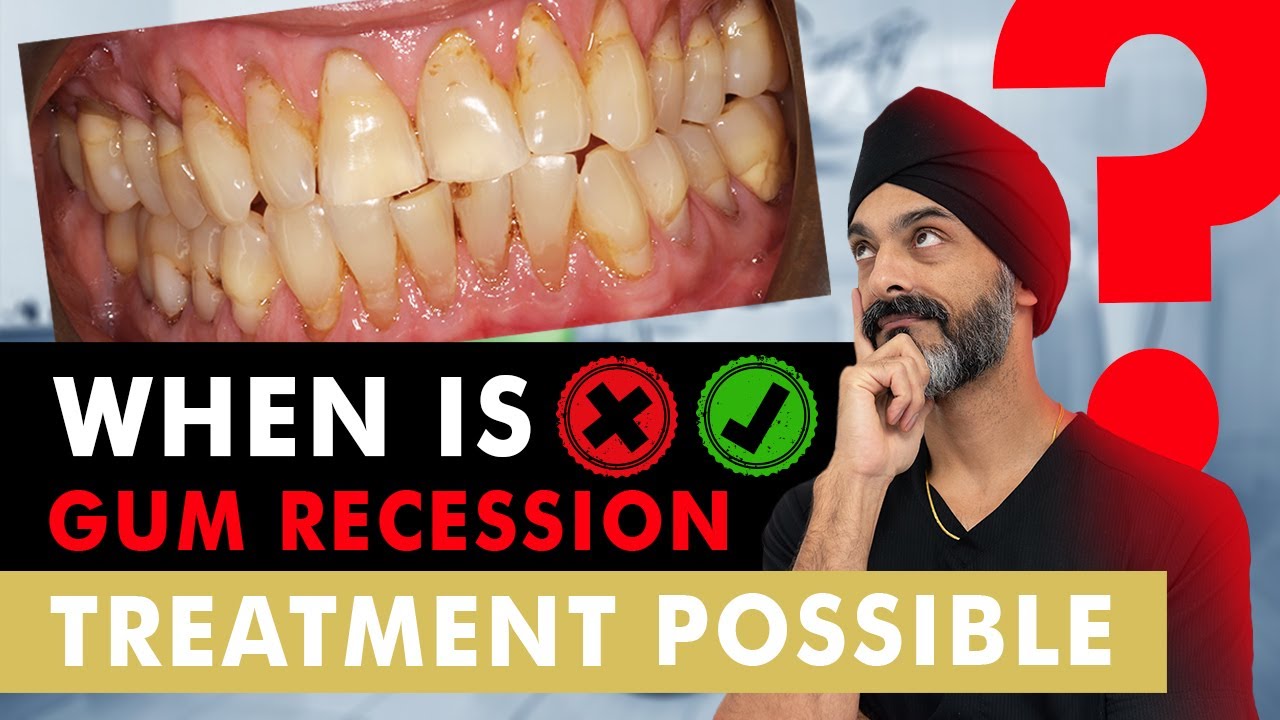 Gum Recession - Is there a cure? - YouTube
