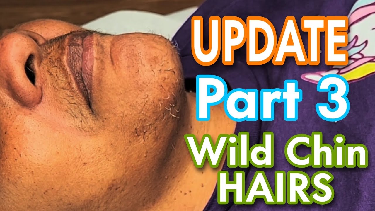PART 3: Waxing Wild/Sporadic Chin Hairs! She Drives An Hour Each Time!🥰 ...