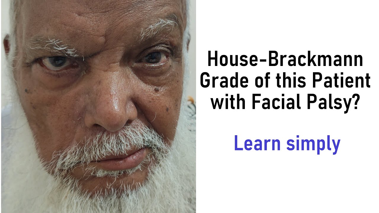 How to Determine the House-Brackmann Grade of a Patient with Facial ...